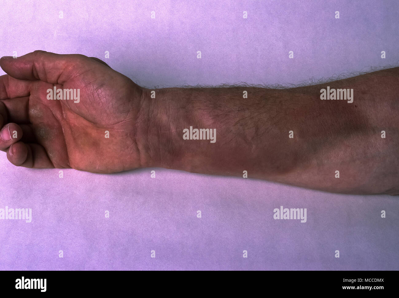 Deployed air bag hi-res stock photography and images - Alamy