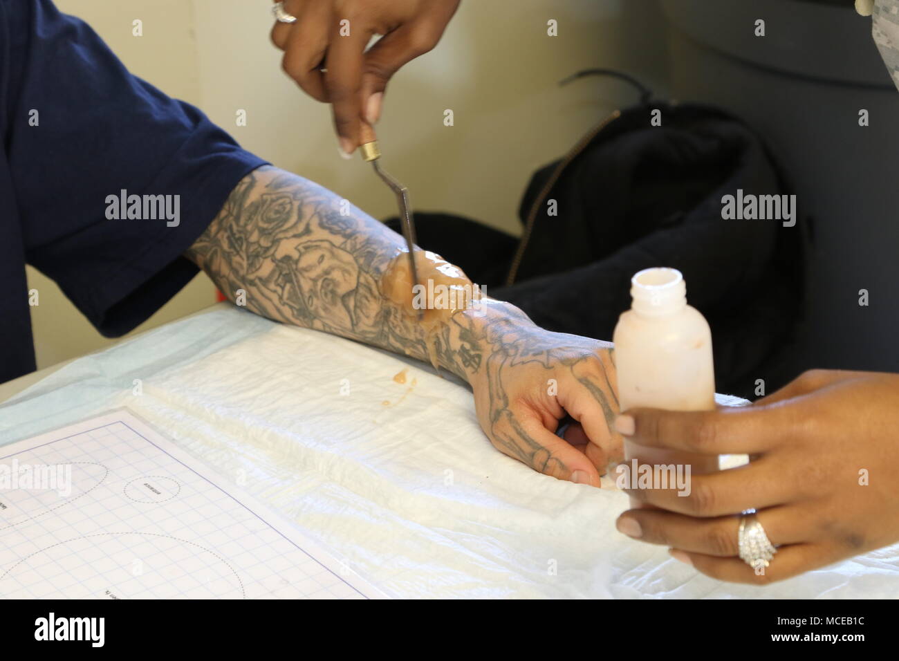 Fake injury hi-res stock photography and images - Alamy