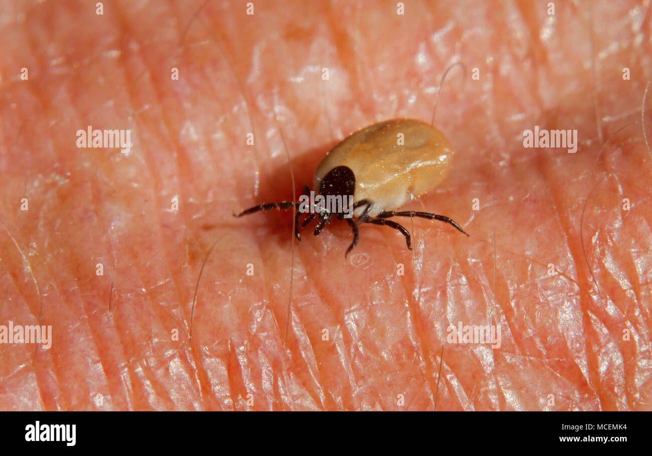 A Castor bean tick on the wrinkly skin of a hand Stock Photo - Alamy