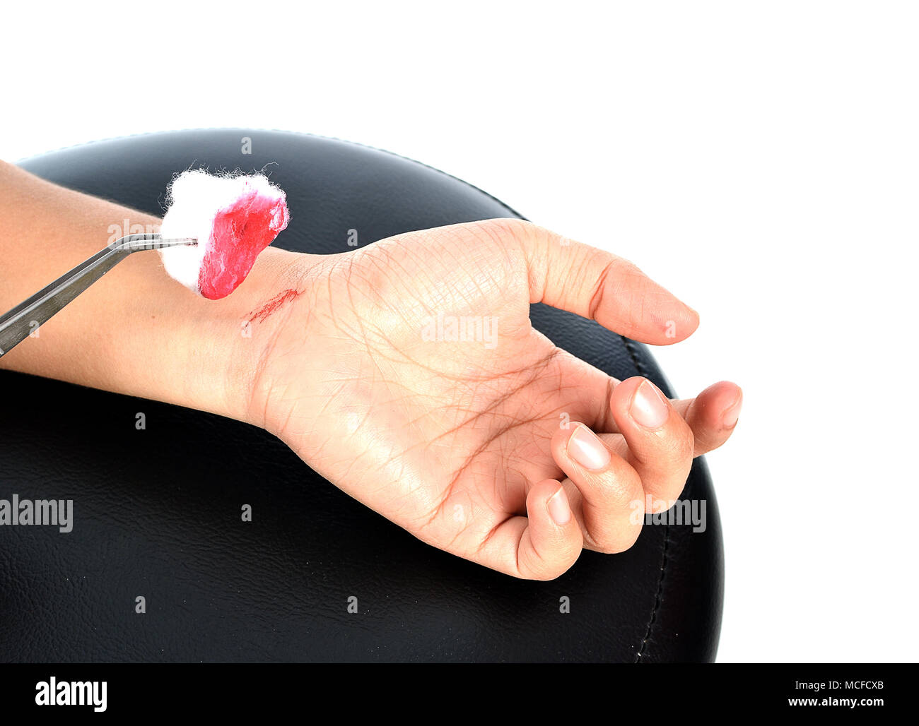 Hand Laceration Stock Photos & Hand Laceration Stock Images - Alamy
