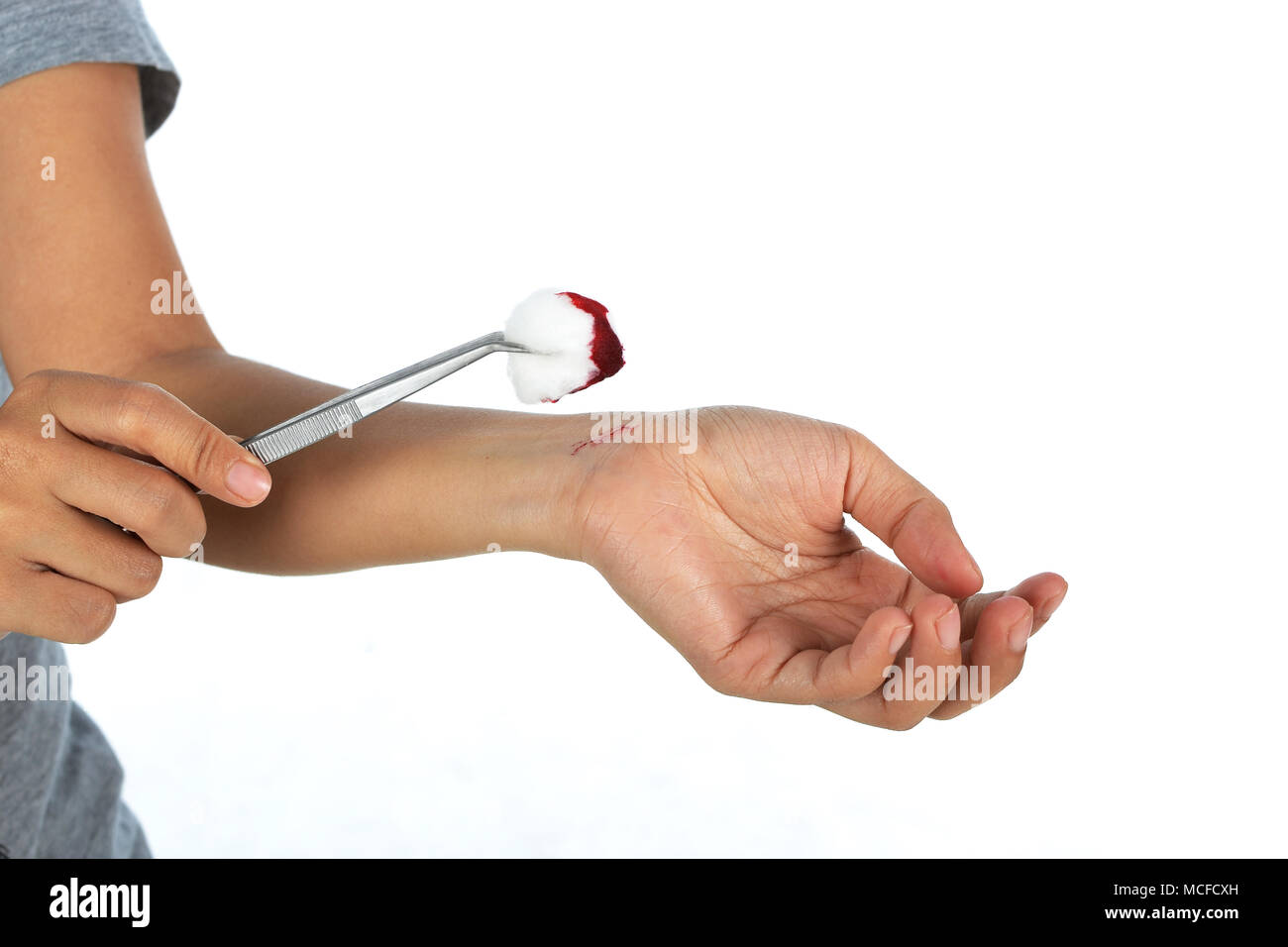 Hand Laceration Stock Photos & Hand Laceration Stock Images - Alamy