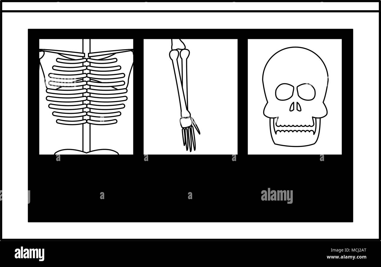 Xray bones images on black and white Stock Vector Image & Art - Alamy