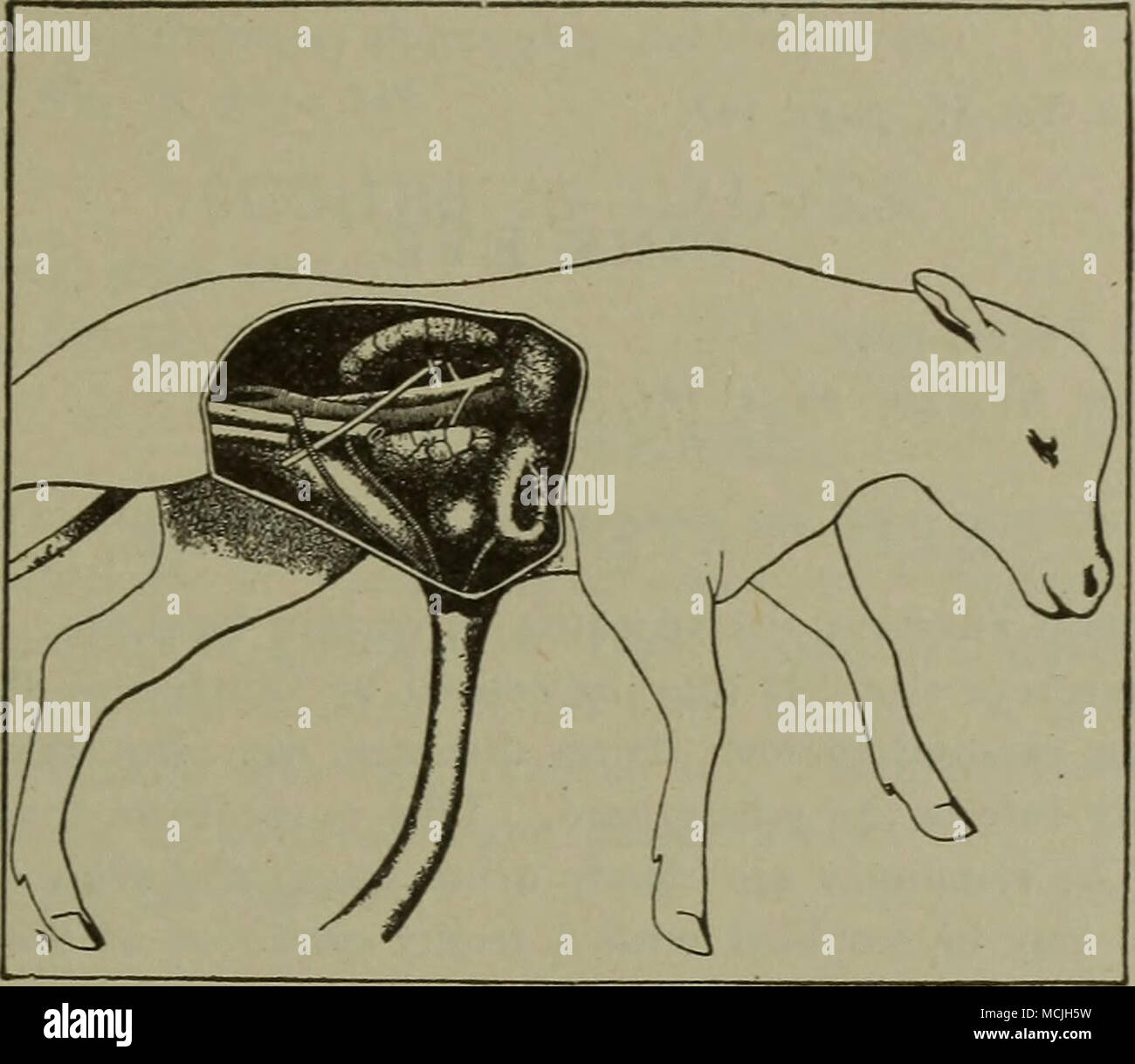 . Navel or Umbilical Cord. PARALYSIS OF THE BOWELS. Paralysis of the ...