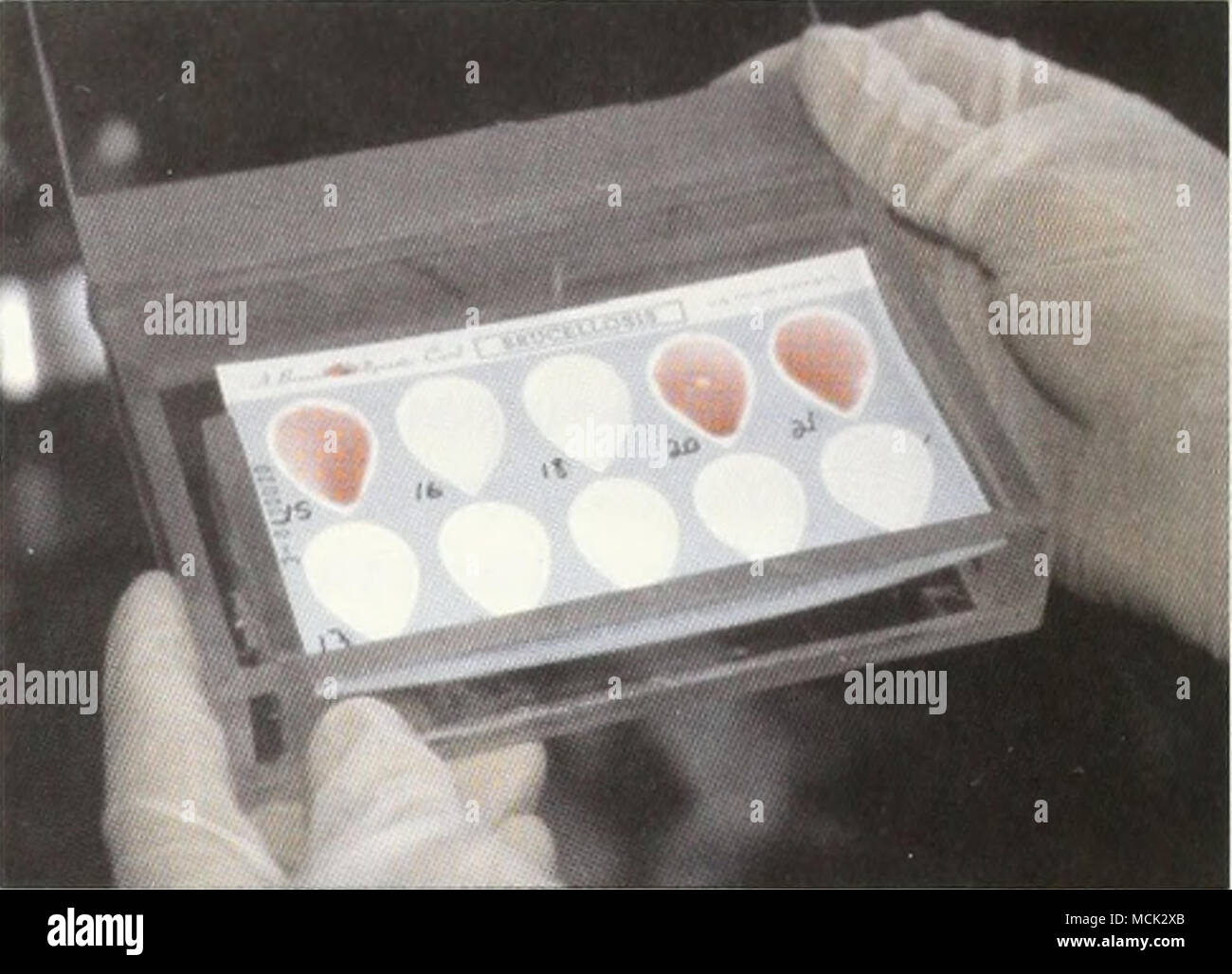 Brucellosis test hi-res stock photography and images - Alamy