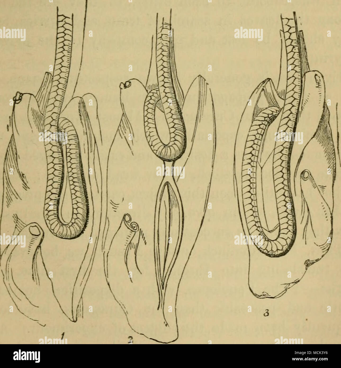 . Organs of voice of 1. Penelope Guan. 2. Penelope Marail. 3. Penelope ...