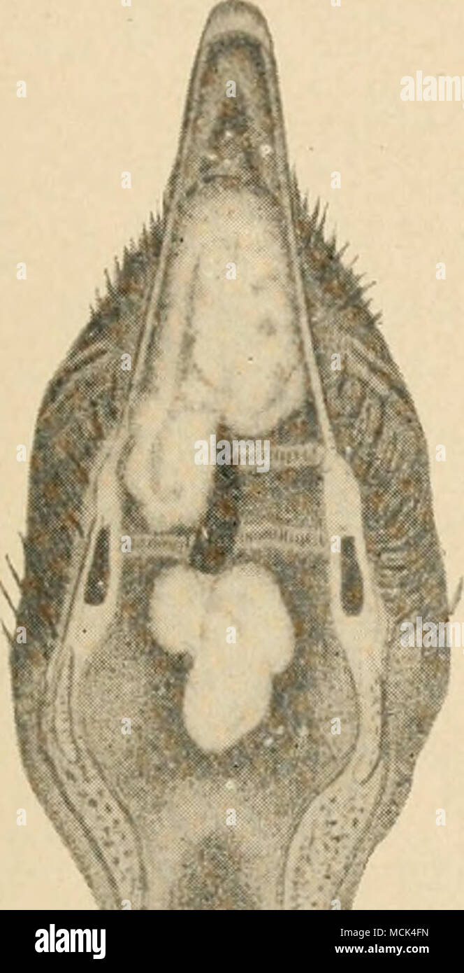 Diphtheria mouth hi-res stock photography and images - Alamy