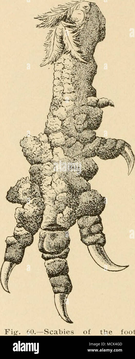 . 60.—Scabies of (scaly legs Stock Photo - Alamy