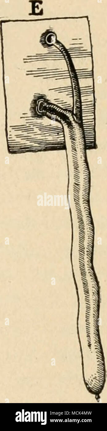 Vesicula seminalis hi-res stock photography and images - Alamy
