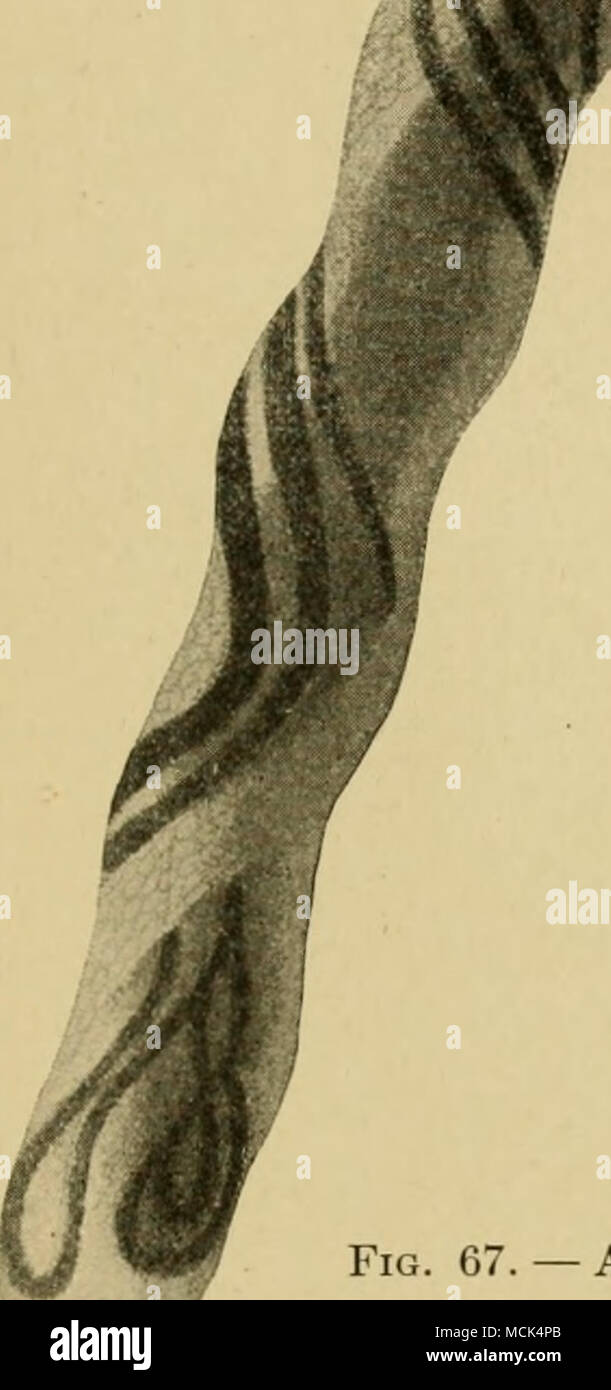. Fig. 67. — A pair of Syngamus trachealis. A, male. B, female. (After ...
