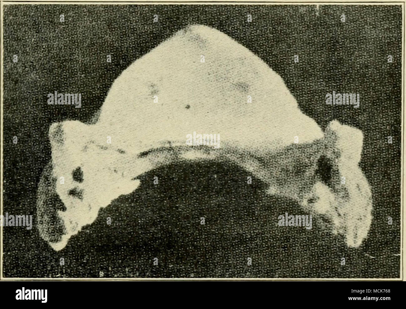 . Fig. 153.—Effects of Periostitis on the Os Pedis. navicular bone, and ...