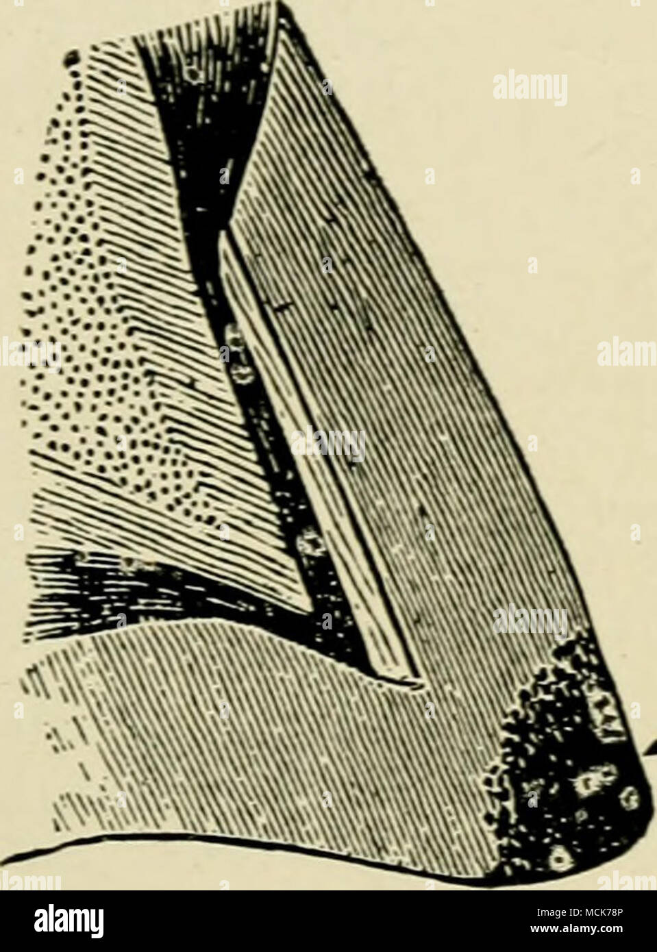 . Fig. 130.—External Seedy-Toe commencing at the Plantar Border of the ...