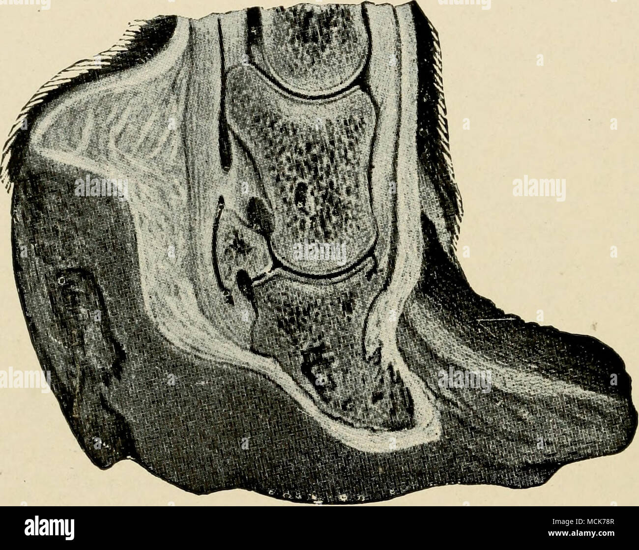 Longitudinal section of bone hi-res stock photography and images - Alamy