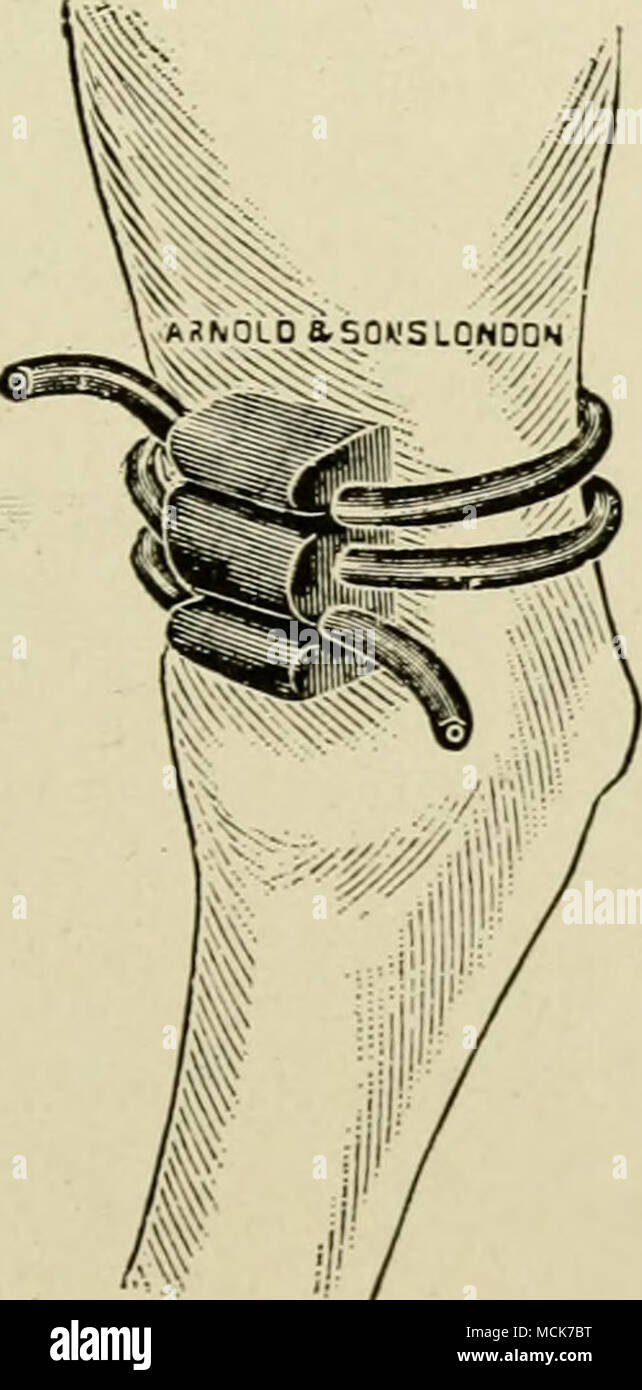 Esmarchs hi-res stock photography and images - Alamy