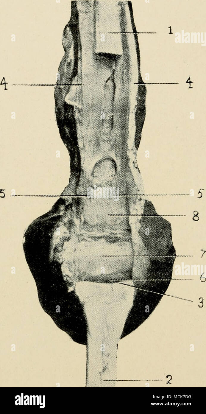 . Fig. 12.—The Flexor Perforates and Flexor Perforans Tendons. The ...