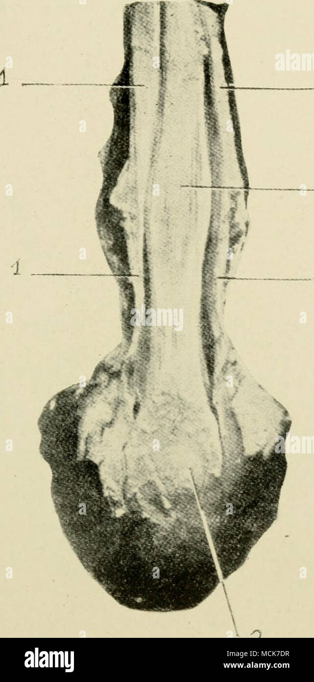 . Fig. 11.—The Flexor Perforans and Flexor Perforatus Tendons. The ...