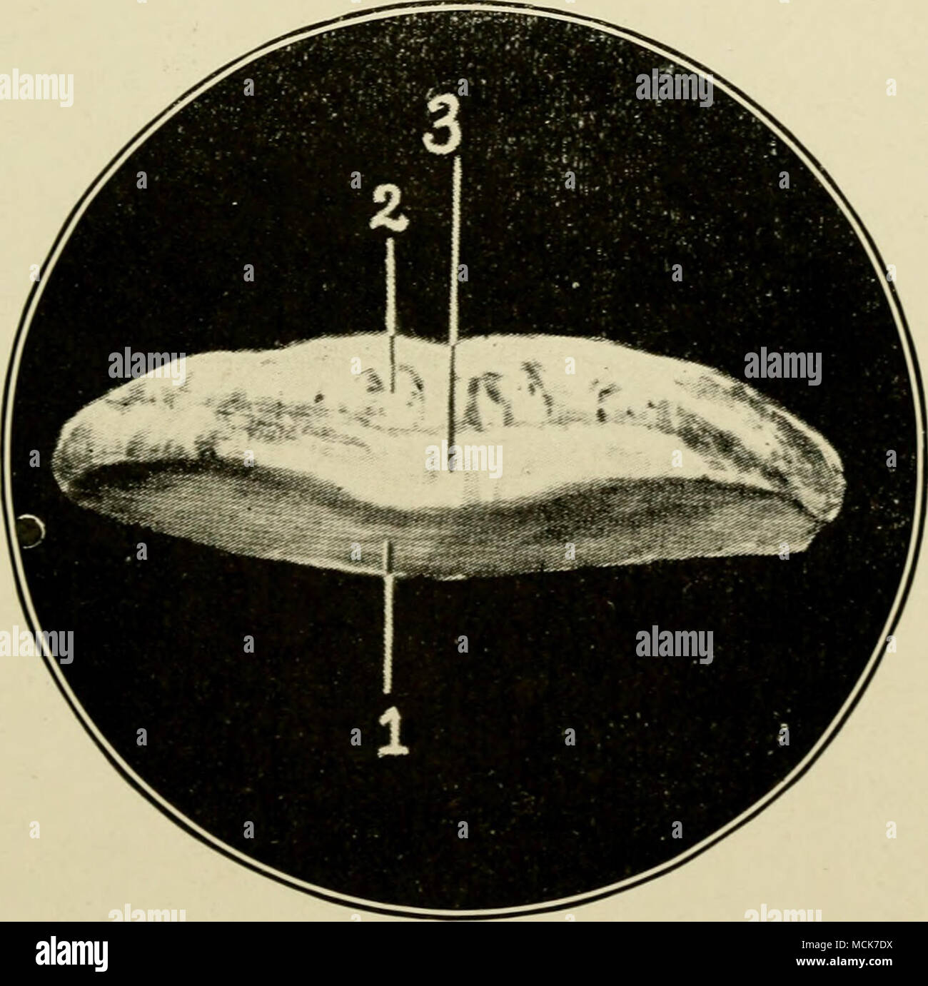 Fig 7—the Navicular Bone Viewed From Above The Bone Tilted Posteriorly To Show Its