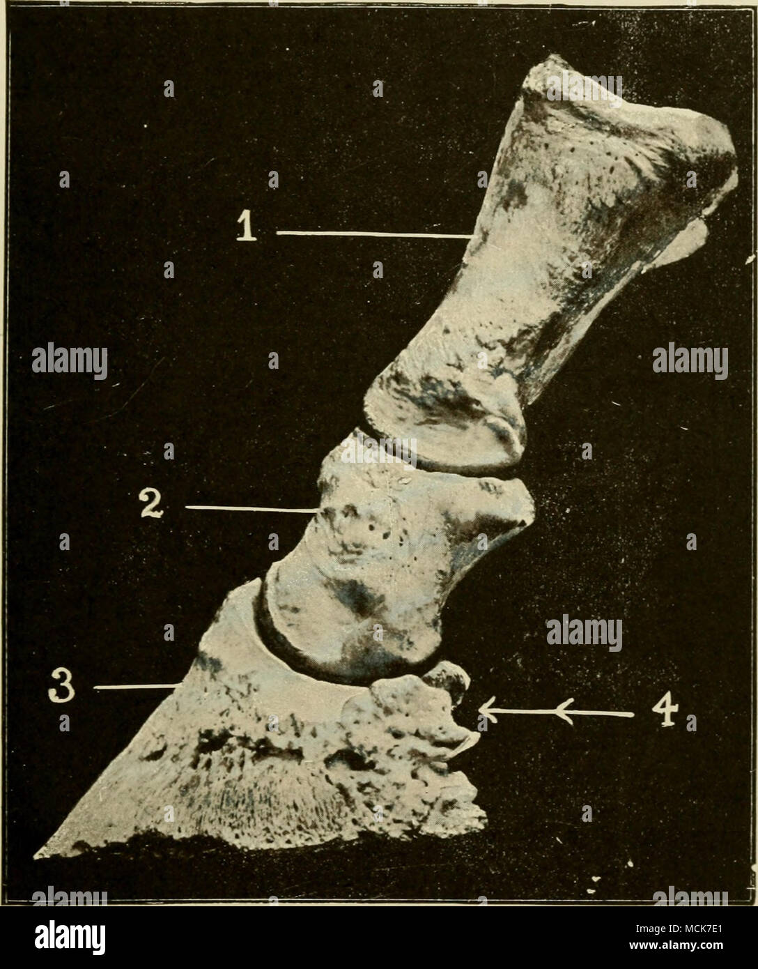. Fig. 1.—The Bones of the Phalanx. i, The os suffraginis; 2, the os ...