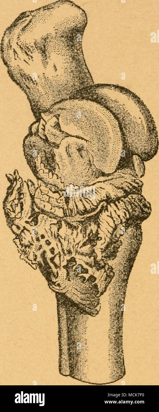 Spavin hi-res stock photography and images - Alamy