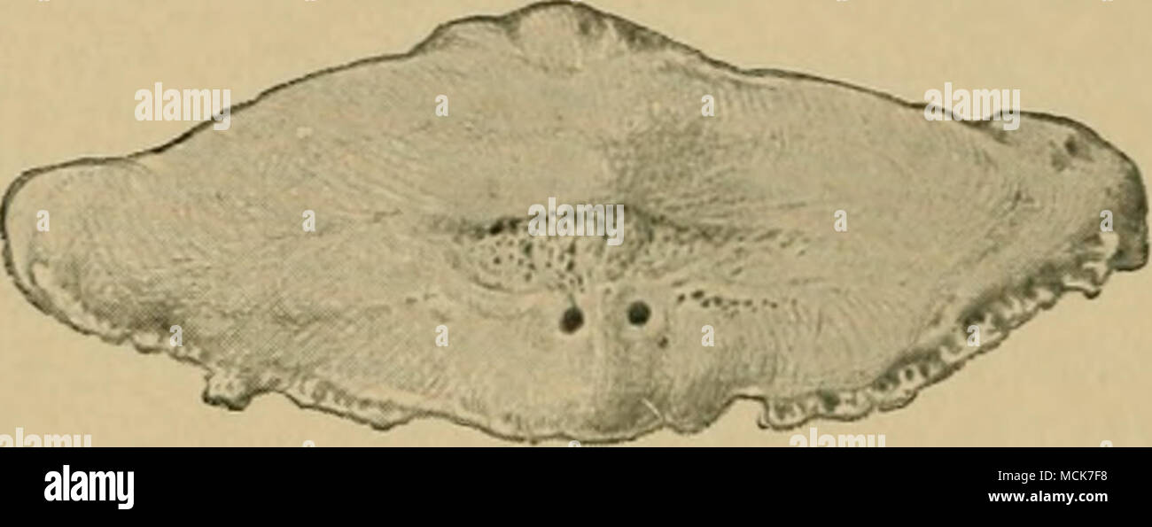 Hyaline cartilage hi-res stock photography and images - Alamy