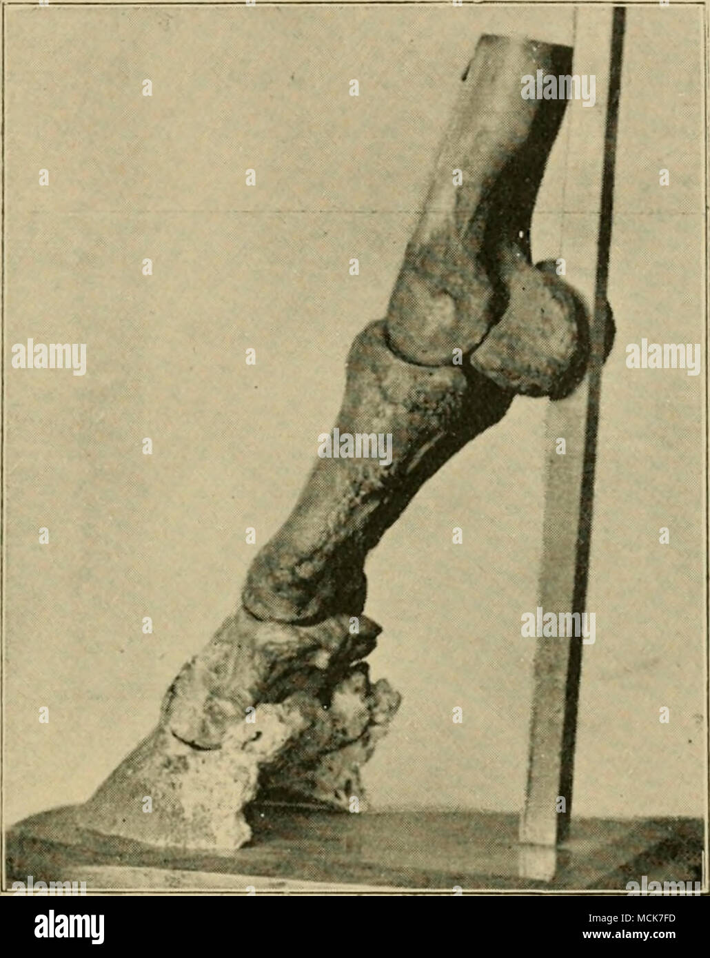 . Fig. 151. -Effects of Pkriostitis on the Pedal and Navicular Bones ...