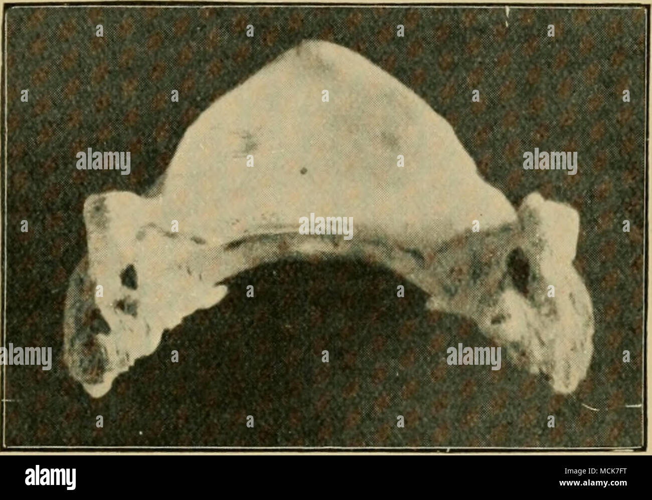 . Fig. 153.—Effects of Periostitis on the Os Pedis. navicular bone, and ...