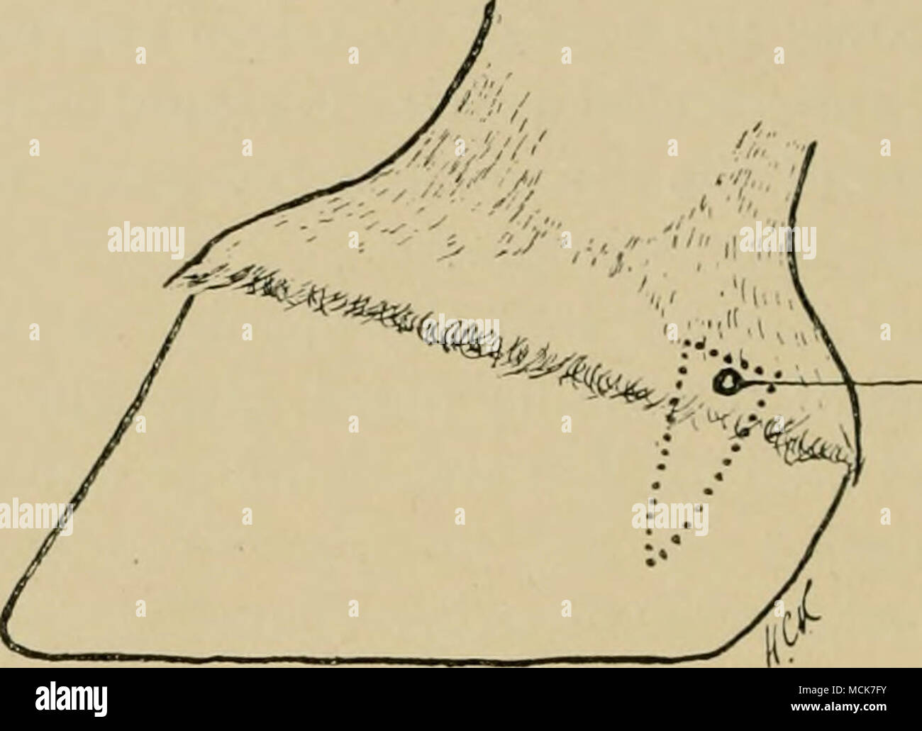 Described as skin dressing hi-res stock photography and images - Alamy