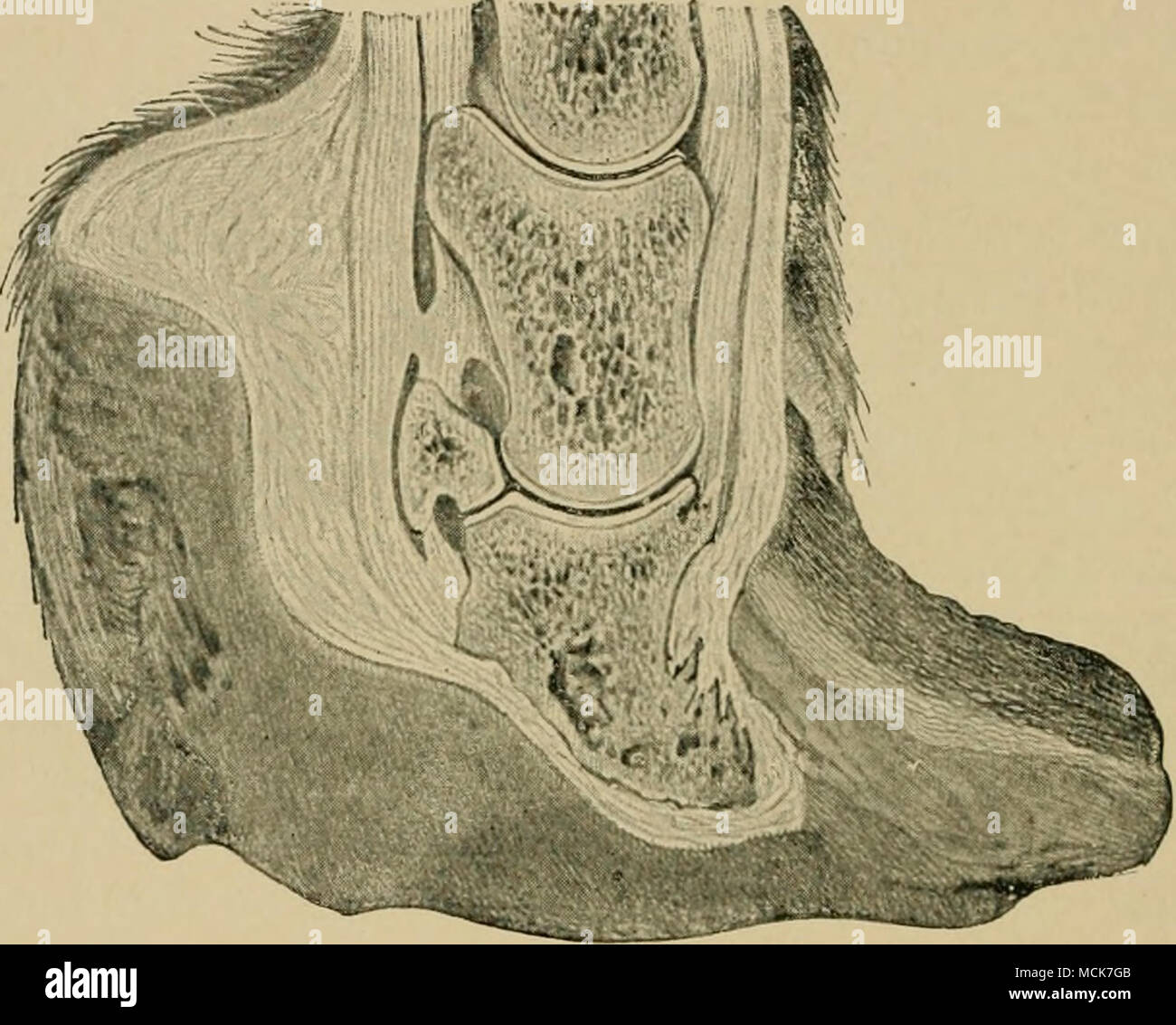 Longitudinal section of bone hi-res stock photography and images - Alamy