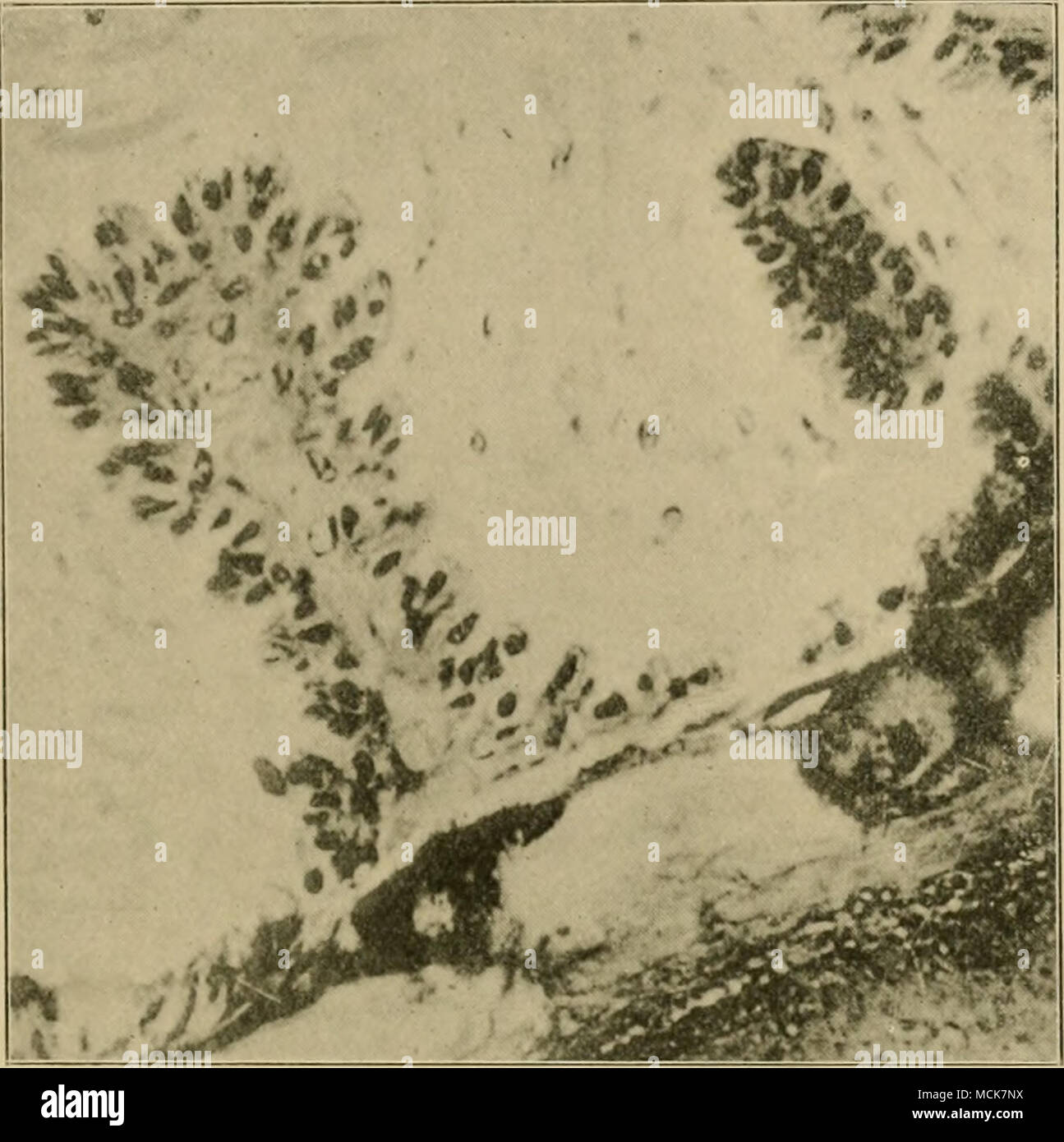 . FiG. "29.—Section of an Epithelial Ingrowth fk(>3i an Equine FCETUS ...