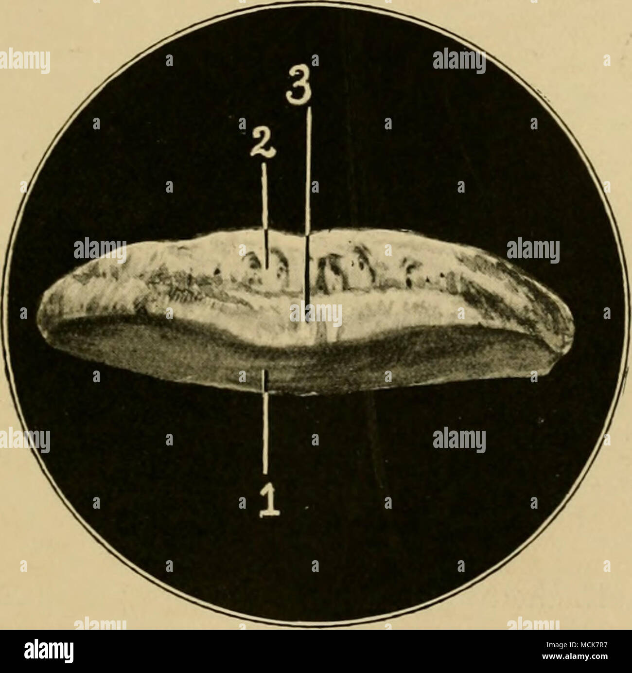 . Fig. 7.—The Navicular Bone (viewed from Above, the Bone Tilted ...