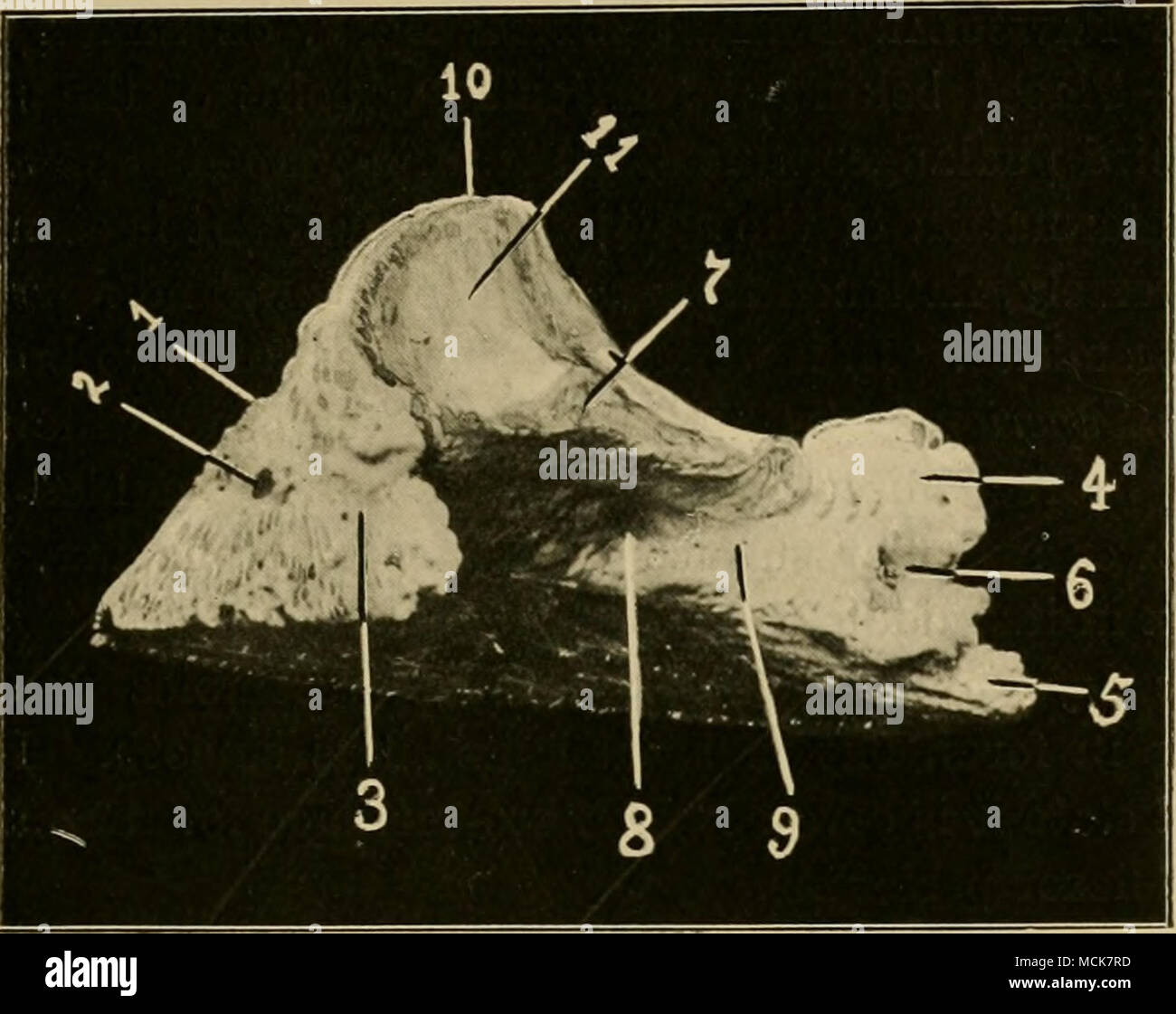 . Fig. 4.—Third Phalanx or Os Pedis (Postero-lateral View). 1, Anterior ...