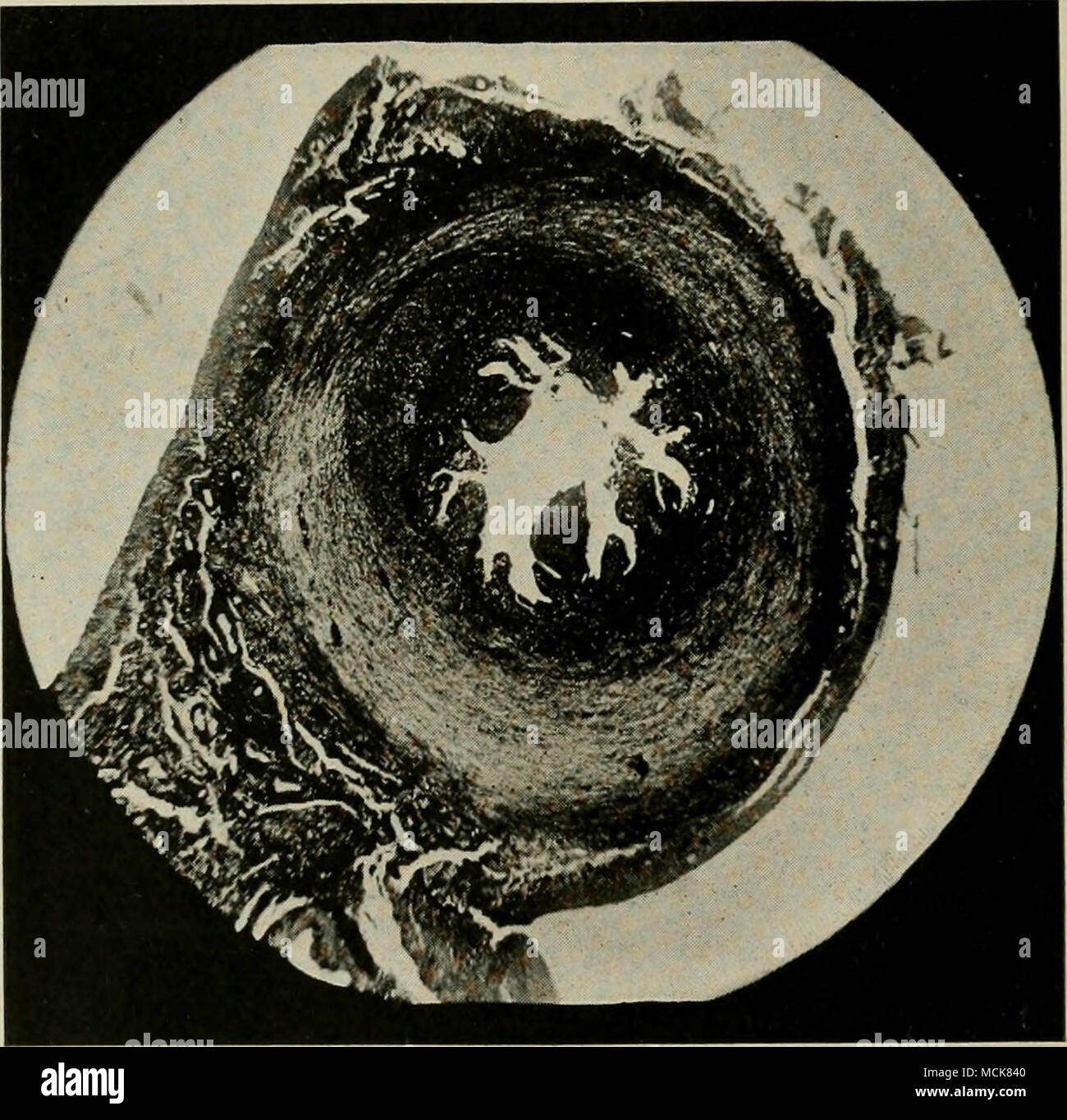 Slight inner hi-res stock photography and images - Alamy