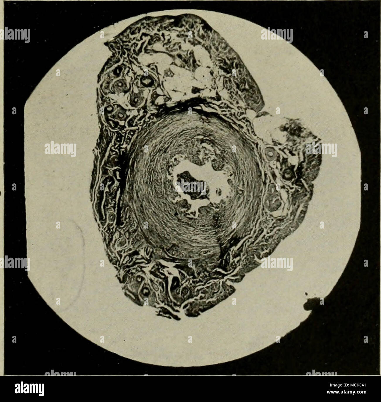 Catarrhal hi-res stock photography and images - Alamy