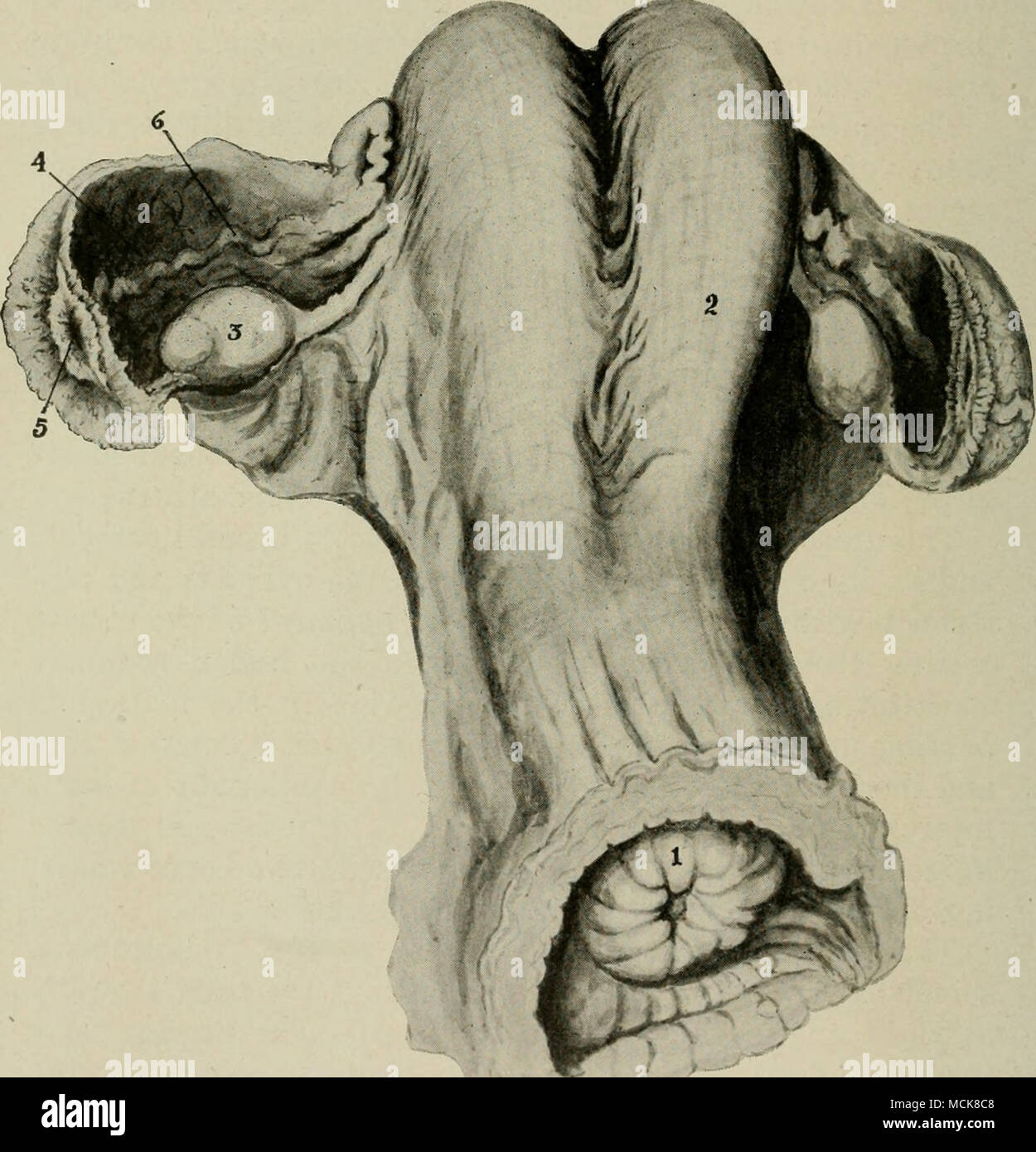 Uterus at oviduct hi-res stock photography and images - Alamy