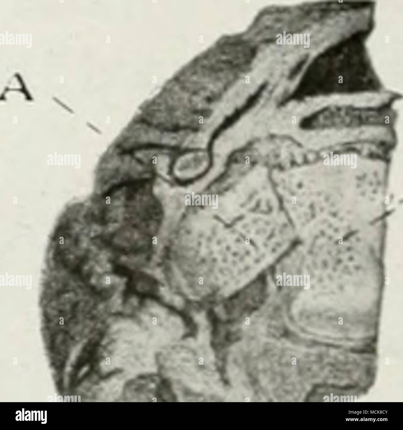 c^ ViGS. 233, 234—Arthritis of Carpus. 233—Longitudinal section through ...