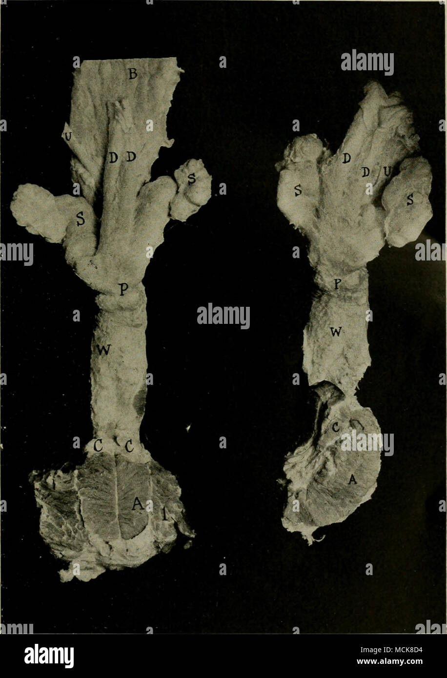 . Fig. 5 Fig. 6 Grlands Attached to Pelvic Urethra of Bull viewed from ...