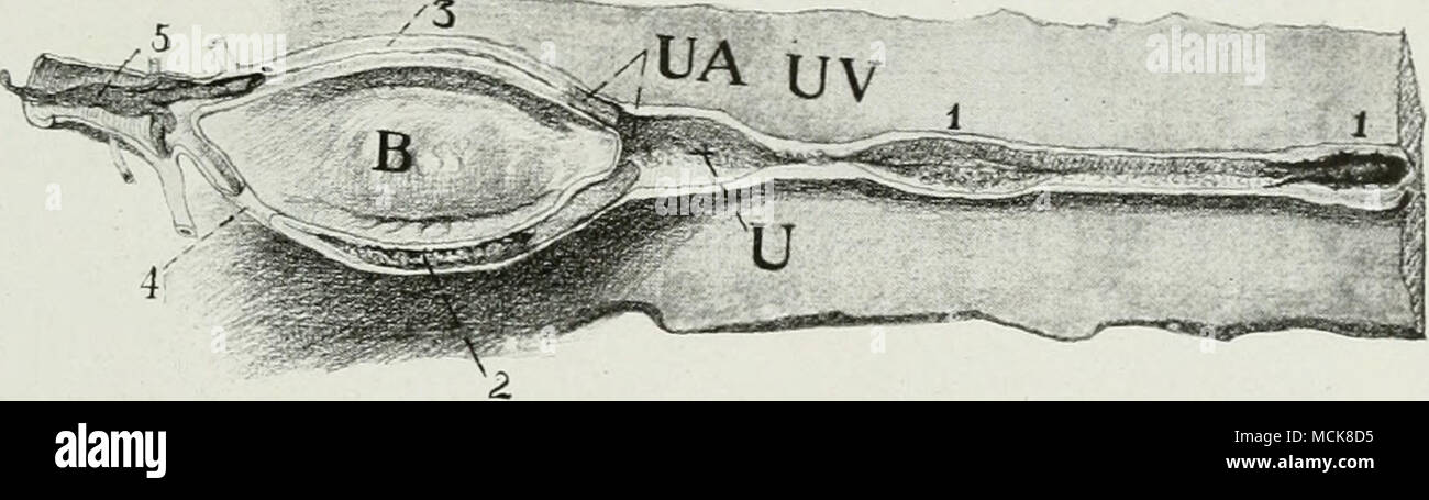 . Fig. 232—Abscess of Umbilic Vein and Artery. Foal. B, Urinary bladder ...