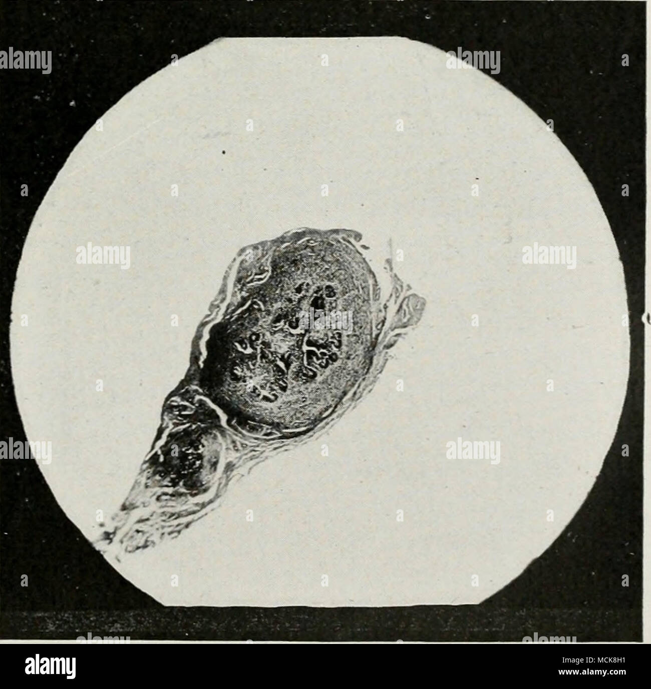 Catarrhal High Resolution Stock Photography and Images - Alamy