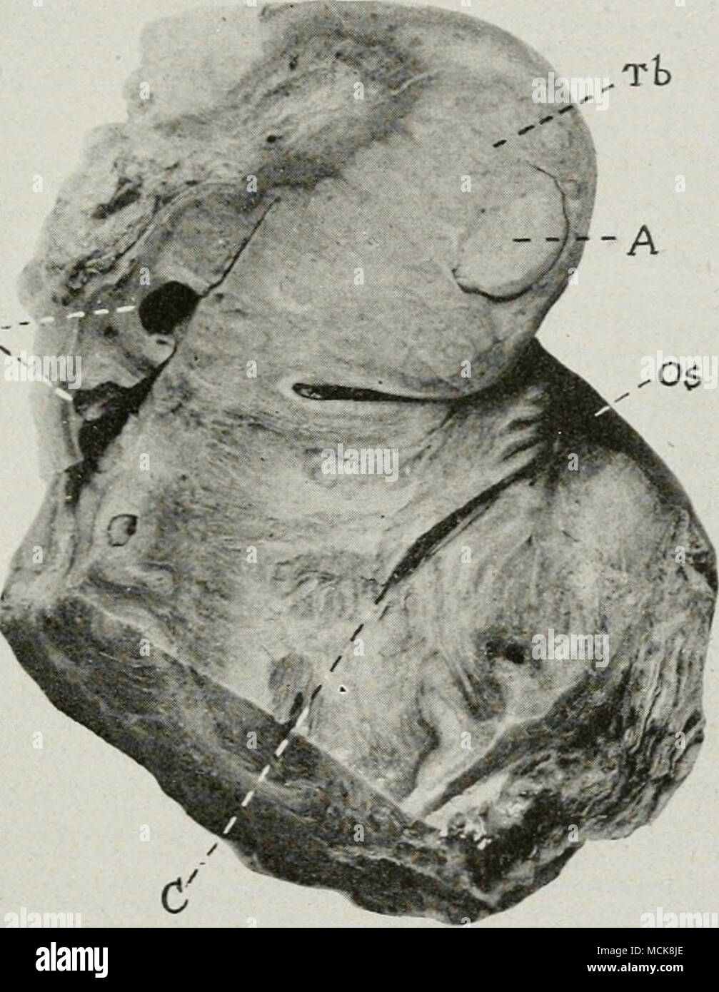 Externum hi-res stock photography and images - Alamy