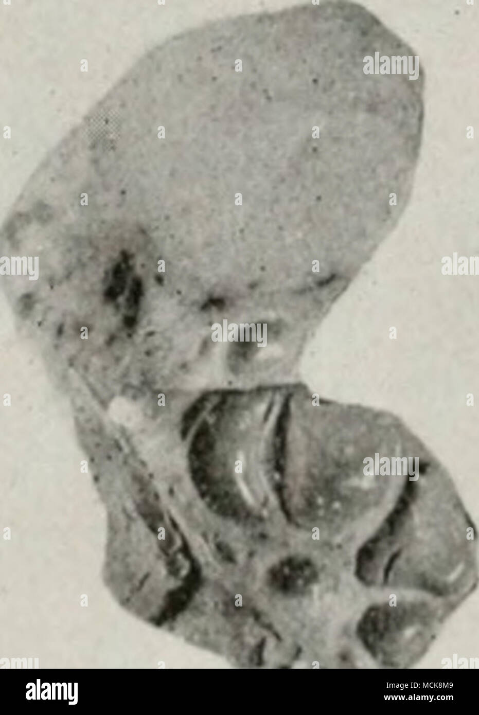 . i.'.r- 7. I.are-e ovarian cyst of preg-nant cow {â ^ho^â v^ with pair ...