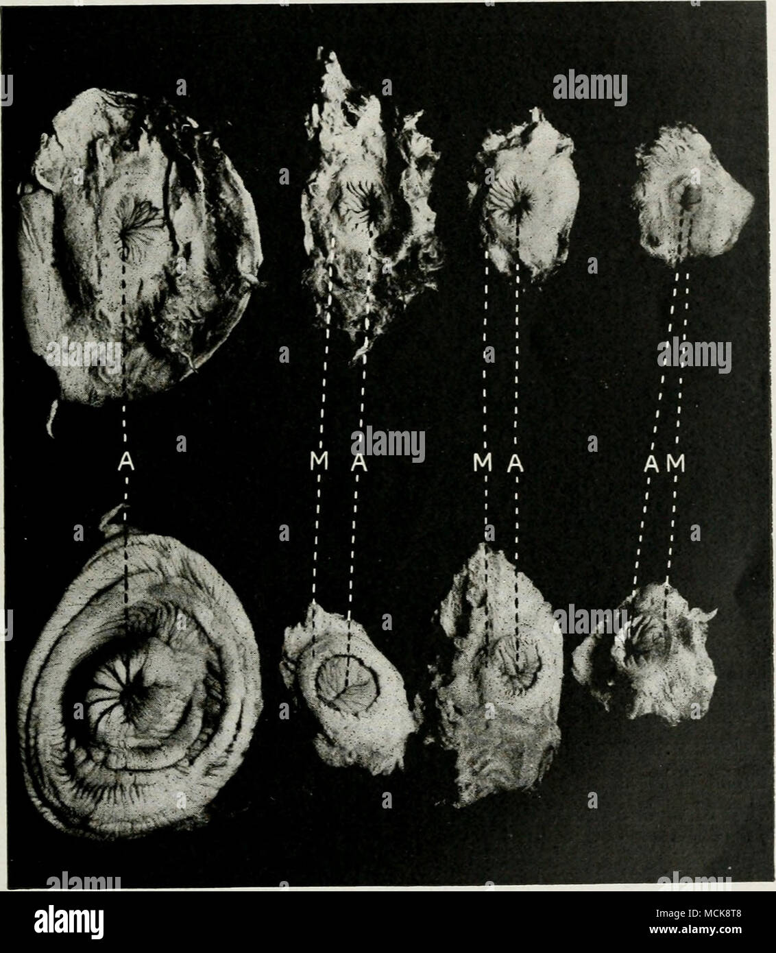 . FiG. i6 (Above) and Fig. 17 (Below). Transverse section of the cervix ...