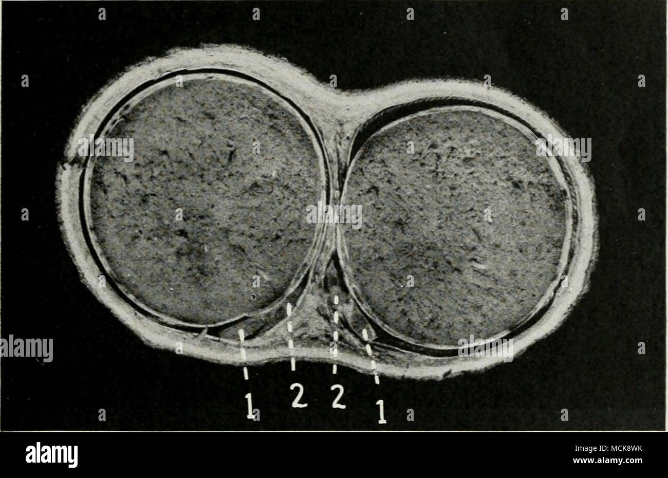 . P^iG. 3—Cross Section through Scrotum and Testicles of Bull Calf ...