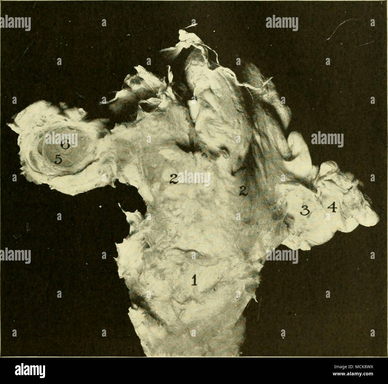 Ductless hi-res stock photography and images - Alamy