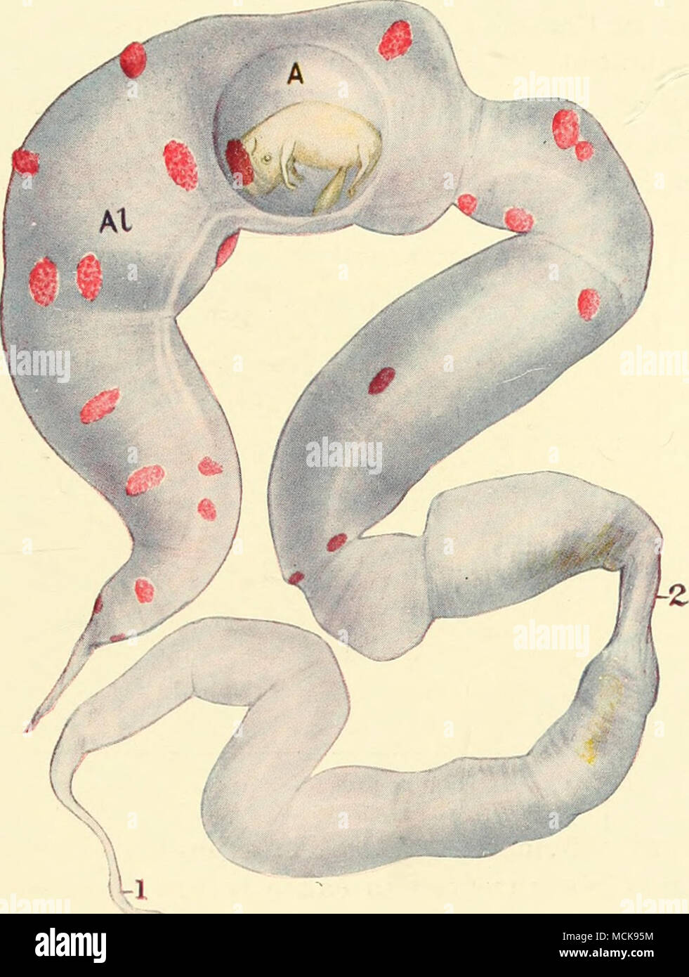 Amnion sac hi-res stock photography and images - Alamy