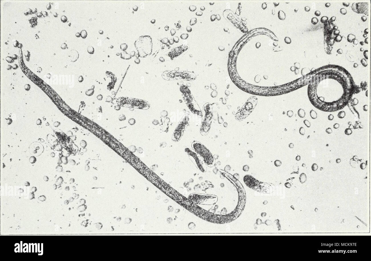 . Fig. 76.—The narcissus stem nematode, with young worms and eggs ...