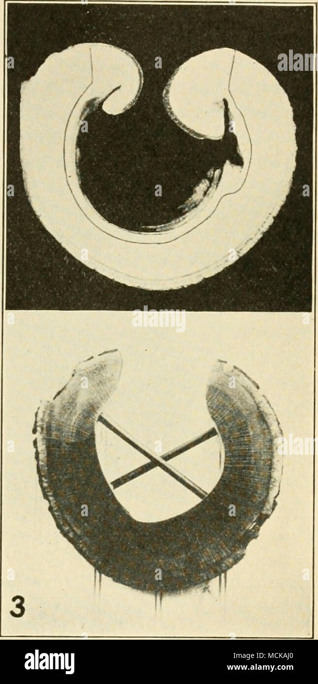 . Fig. 198. — Detailed view of exca- vated and bolted cavities. Above ...