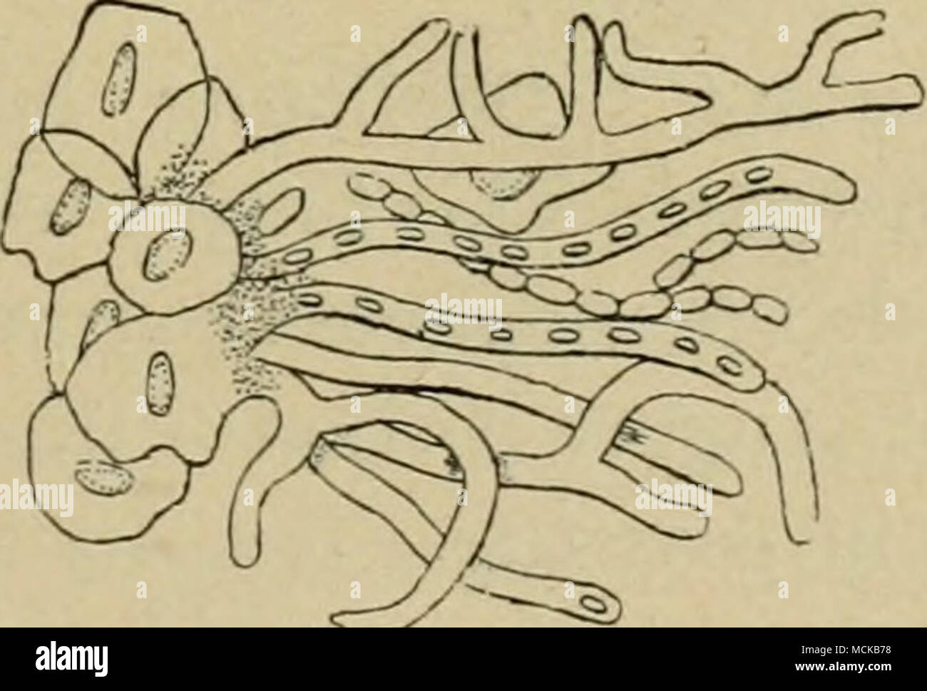 Disease causing fungi hi-res stock photography and images - Alamy