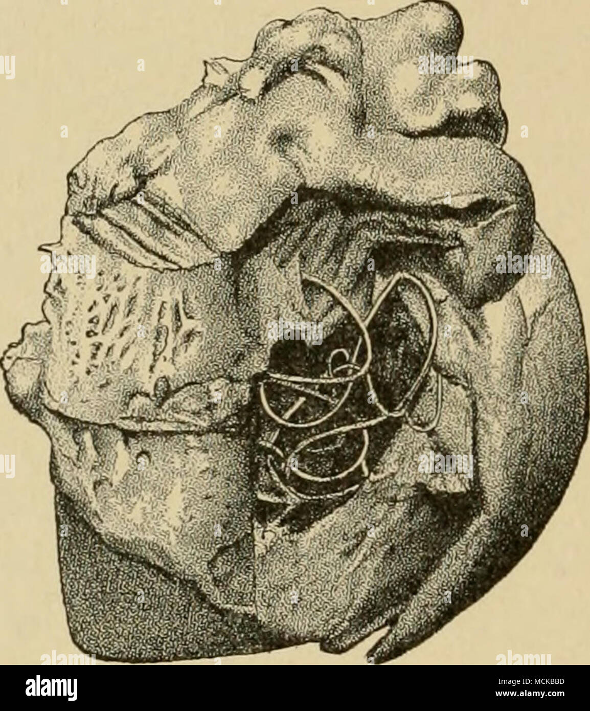 Filaria hi-res stock photography and images - Alamy