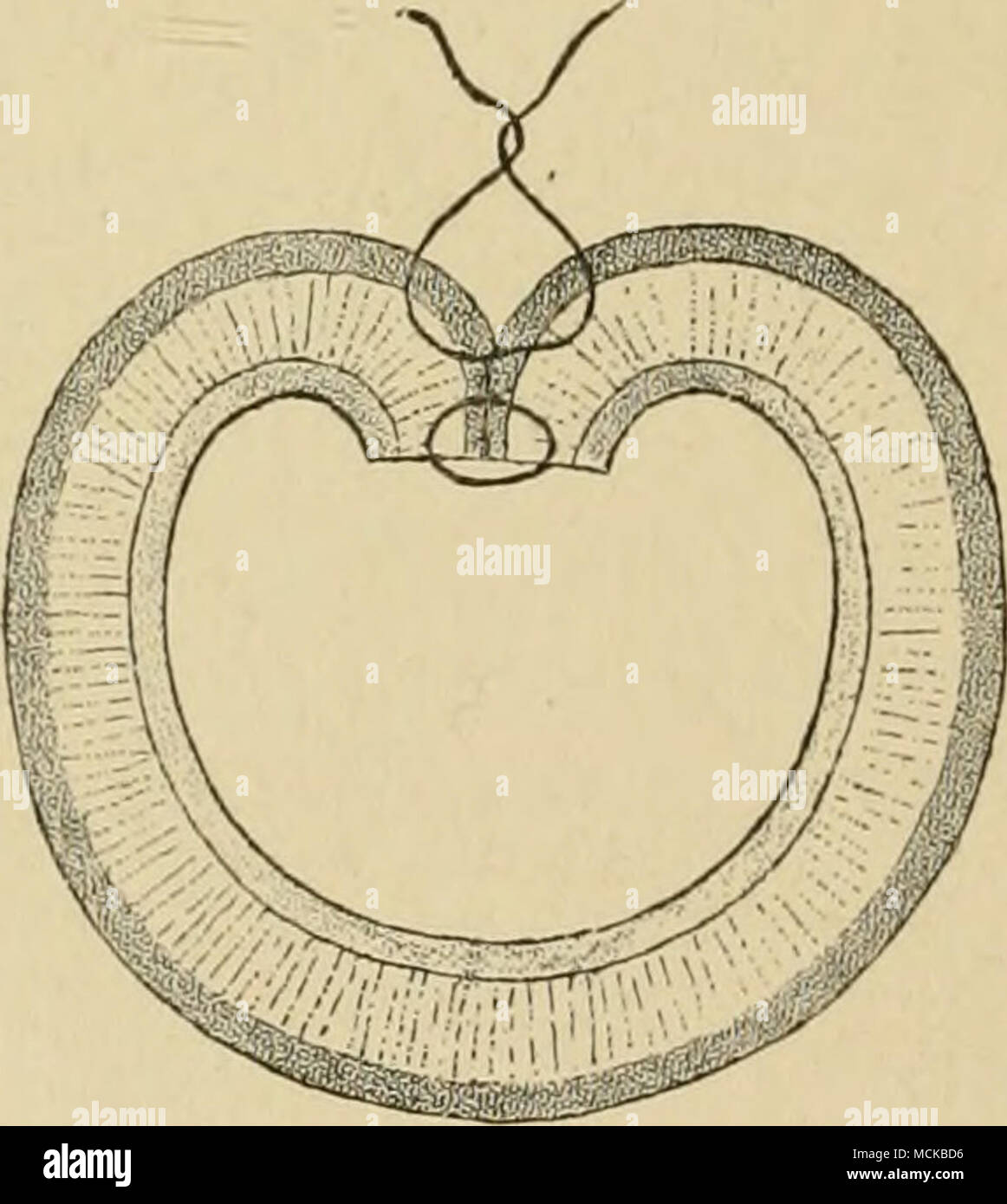 . J/ Suture of the intestines. over the first, as is illustrated in the ...