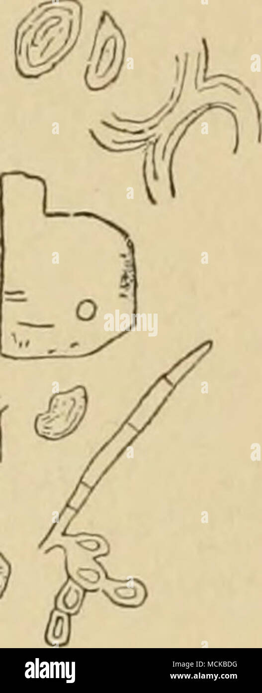 . m 'â Â¥' Microscopical examination of the feces. Vegetable matter ...