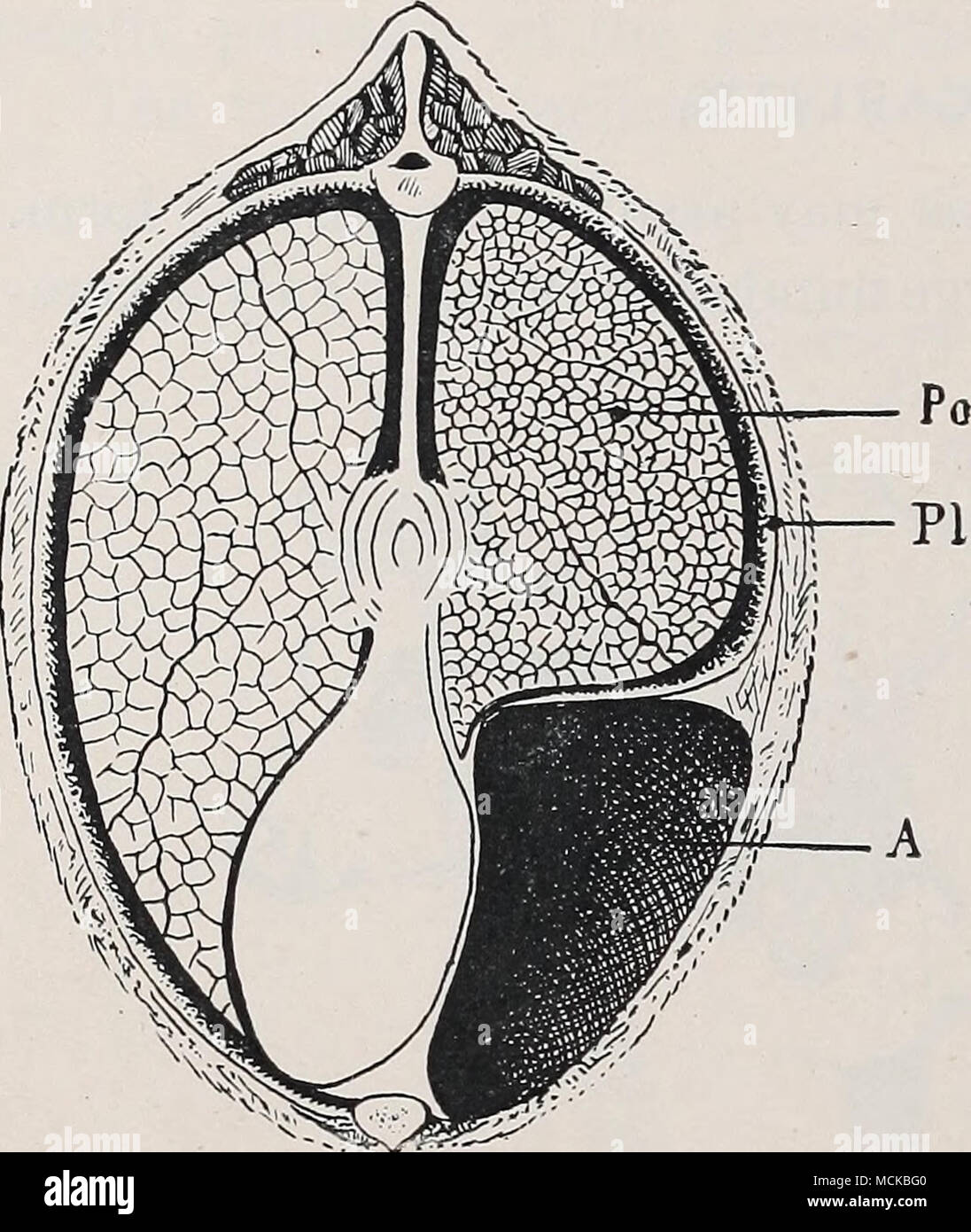. Fig. 181. — Schema of a subpleural abscess on the right side which ...